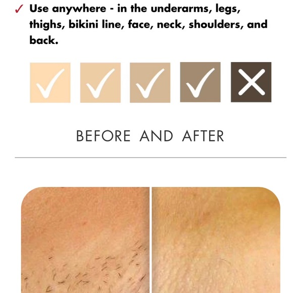 Skincare | Snowy Skin Advanced Ipl Laser Hair Removal Handset | Poshmark